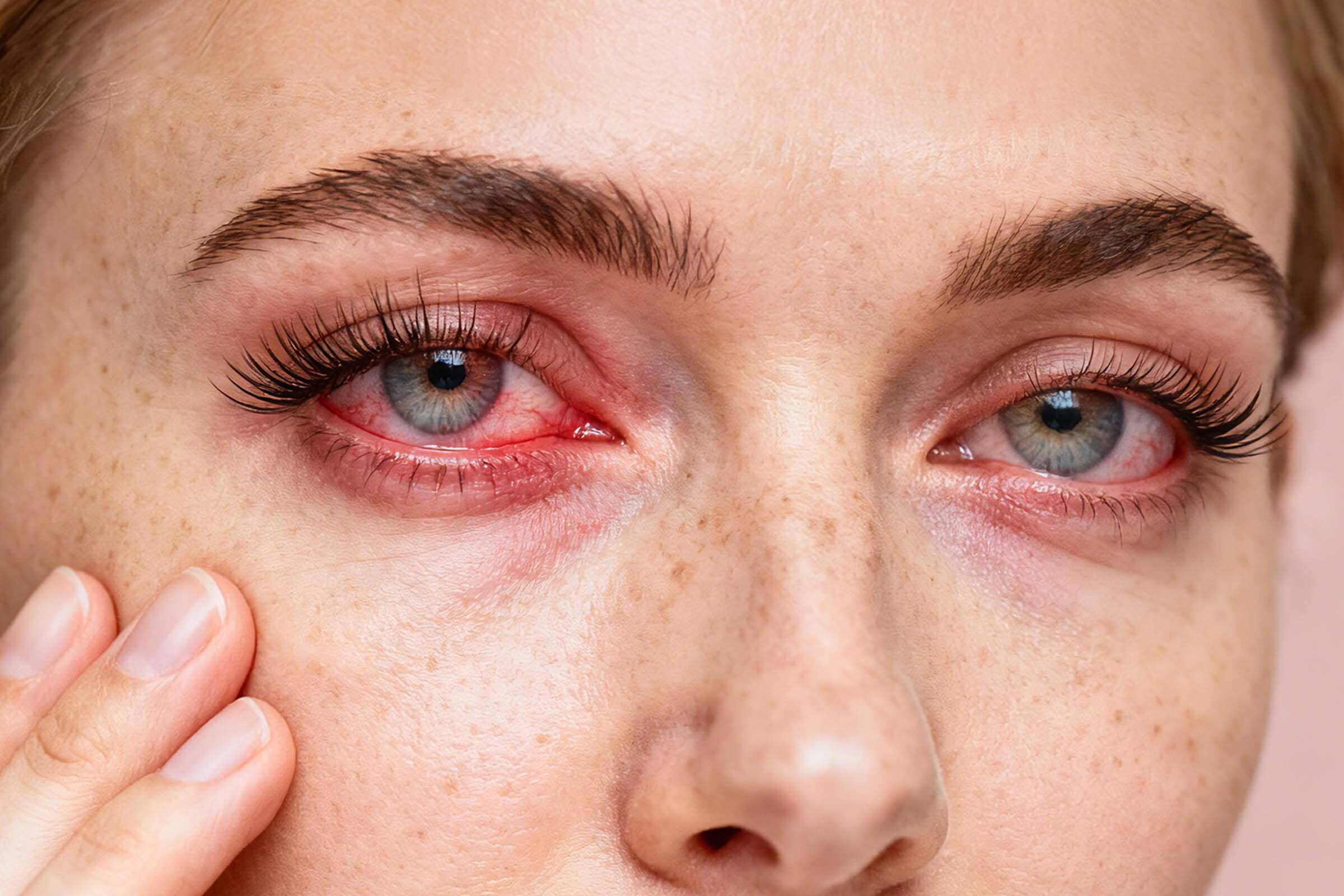 Best Lash Glue for Sensitive Eyes: No More Redness & Swelling – VEYELASH